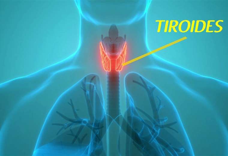 Todo lo que necesita saber sobre la tiroiditis de Hashimoto | Teletica