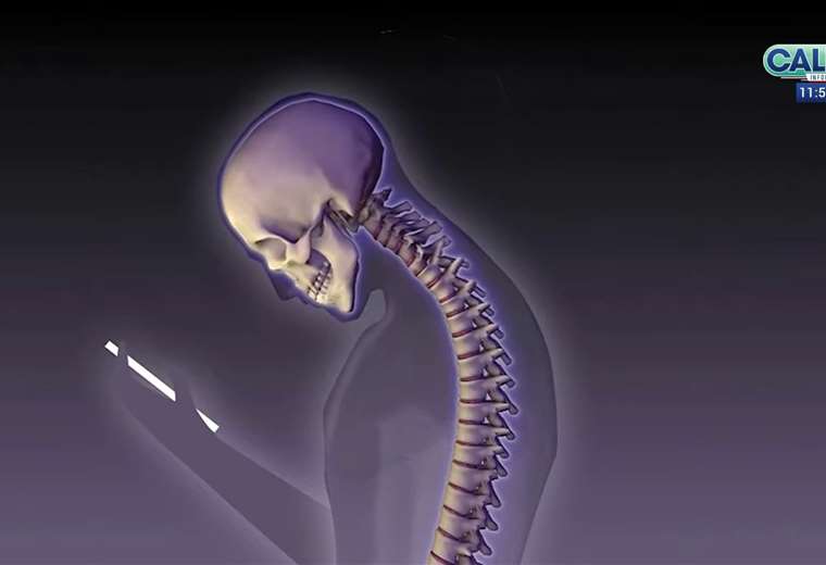 Encorvarse para usar celular podría añadir 27 kilos a su espalda ...