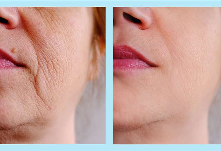 ¿Flacidez en la piel del rostro? Estos tratamientos pueden ayudarle ...