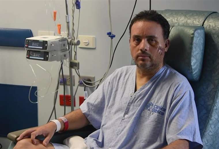 “Fue una mordida de defensa”: biólogo relata cómo sobrevivió ataque de ...